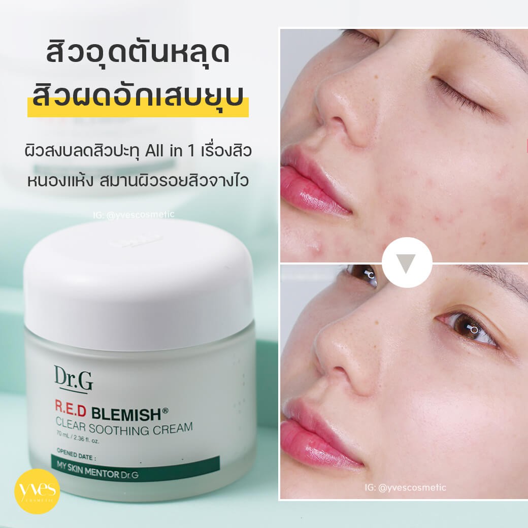 Dr.G R.E.D Blemish Clear Soothing Cream 70ml | Yvescosmetic